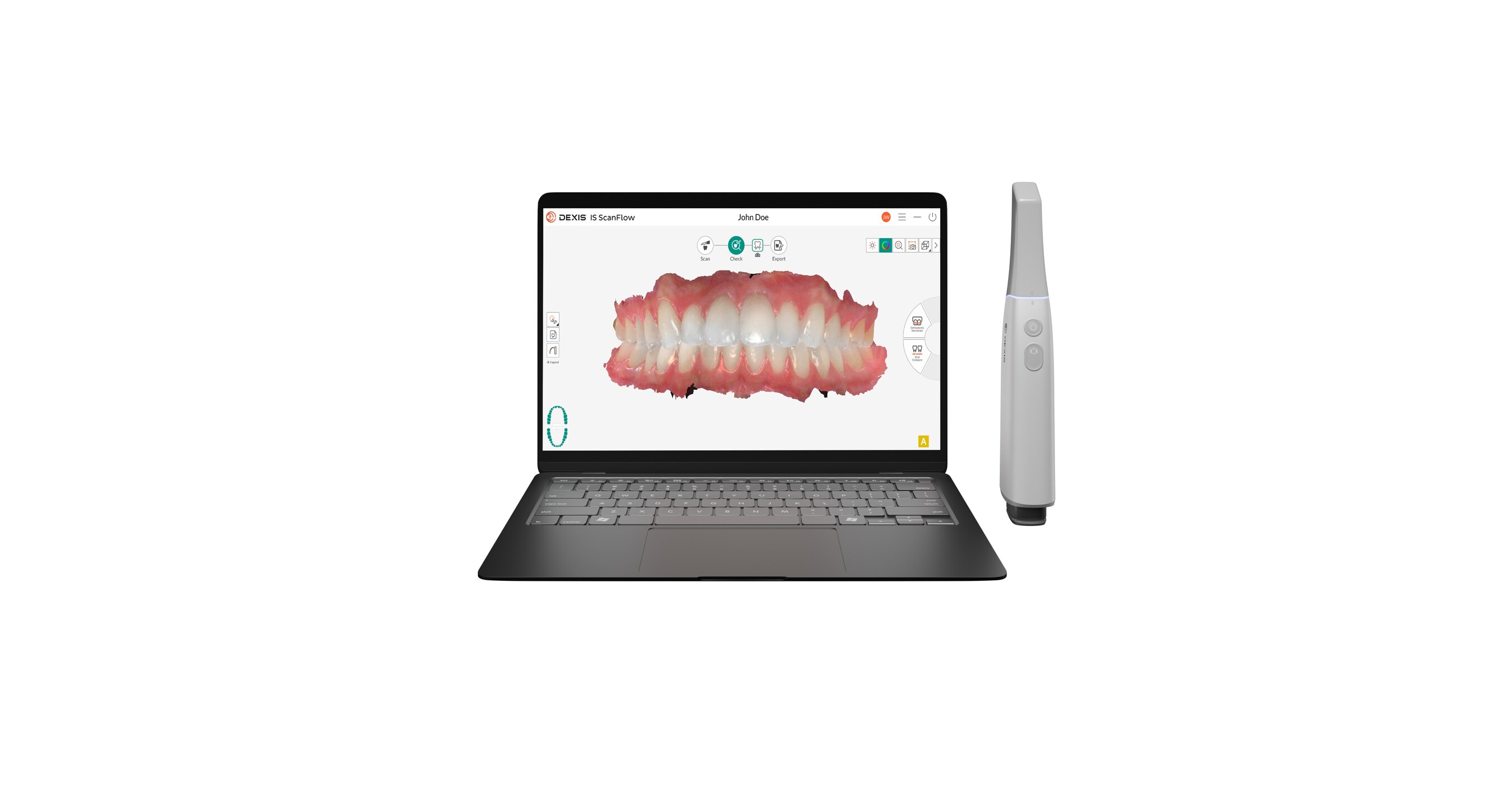 DEXIS™ UNVEILS IMPREVO SCANNER, POWERED BY IS SCANFLOW INNOVATION