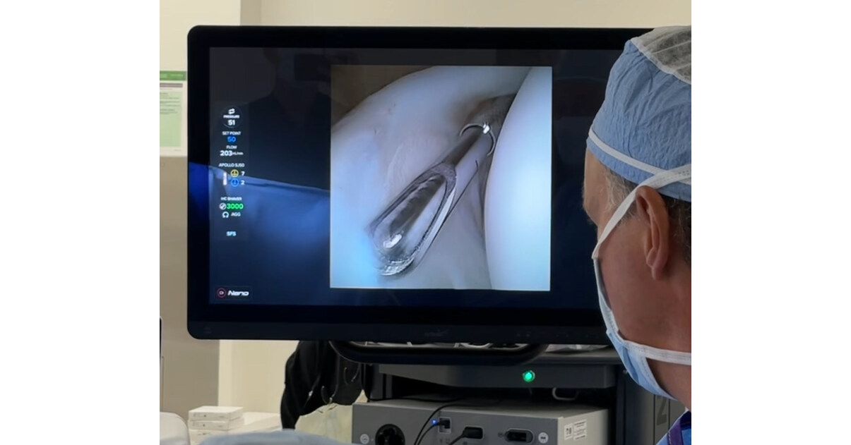 Arthrex Achieves First Case with NanoNeedle™ Scope 2.0
