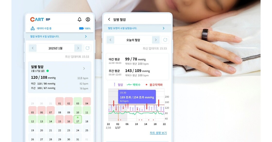 Sky Labs Launches CART BP, a Ring-Type Cuffless Blood Pressure Monitor