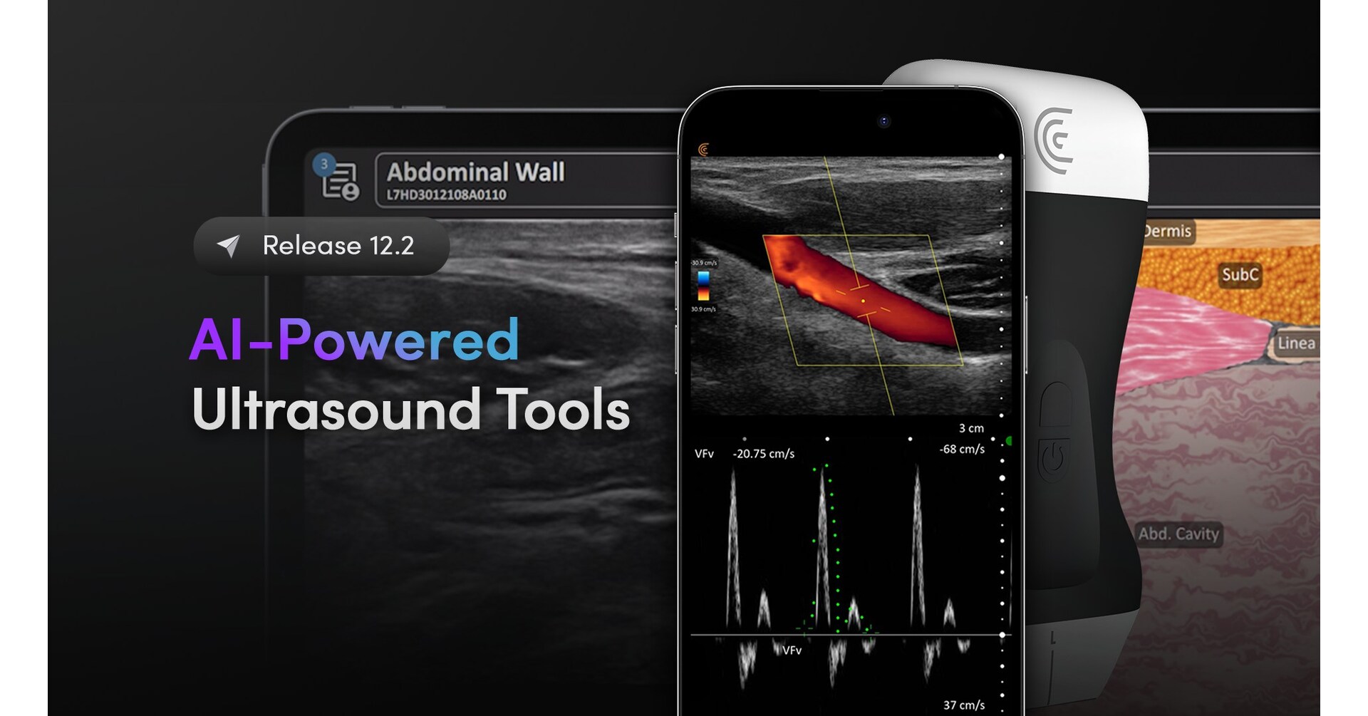Clarius Mobile Health Updates App with AI-Powered Ultrasound Tools for ...