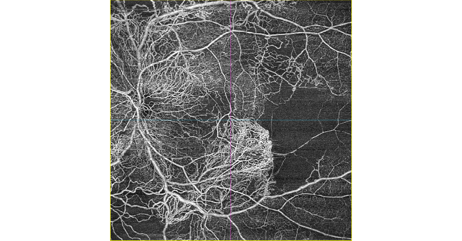 ZEISS expands DORC portfolio and further strengthens digital footprint ...