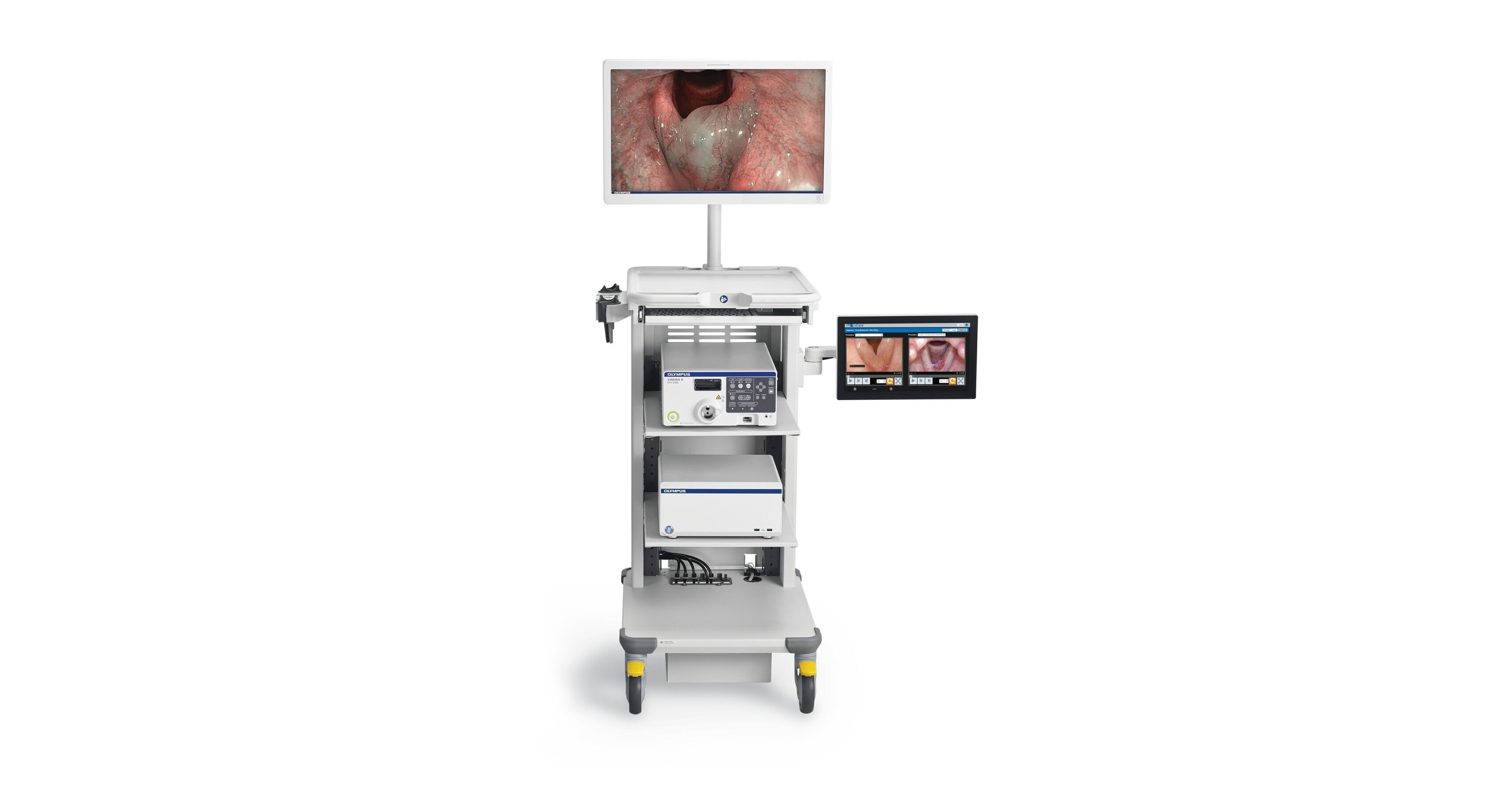Olympus to Highlight Versatile ENT Portfolio of Hybrid Endoscopy and ...