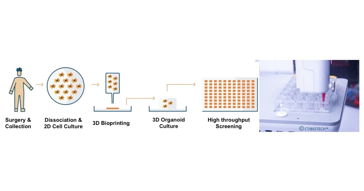 Development of the First Inner Ear Organoids by 3D Bioprinting for ...