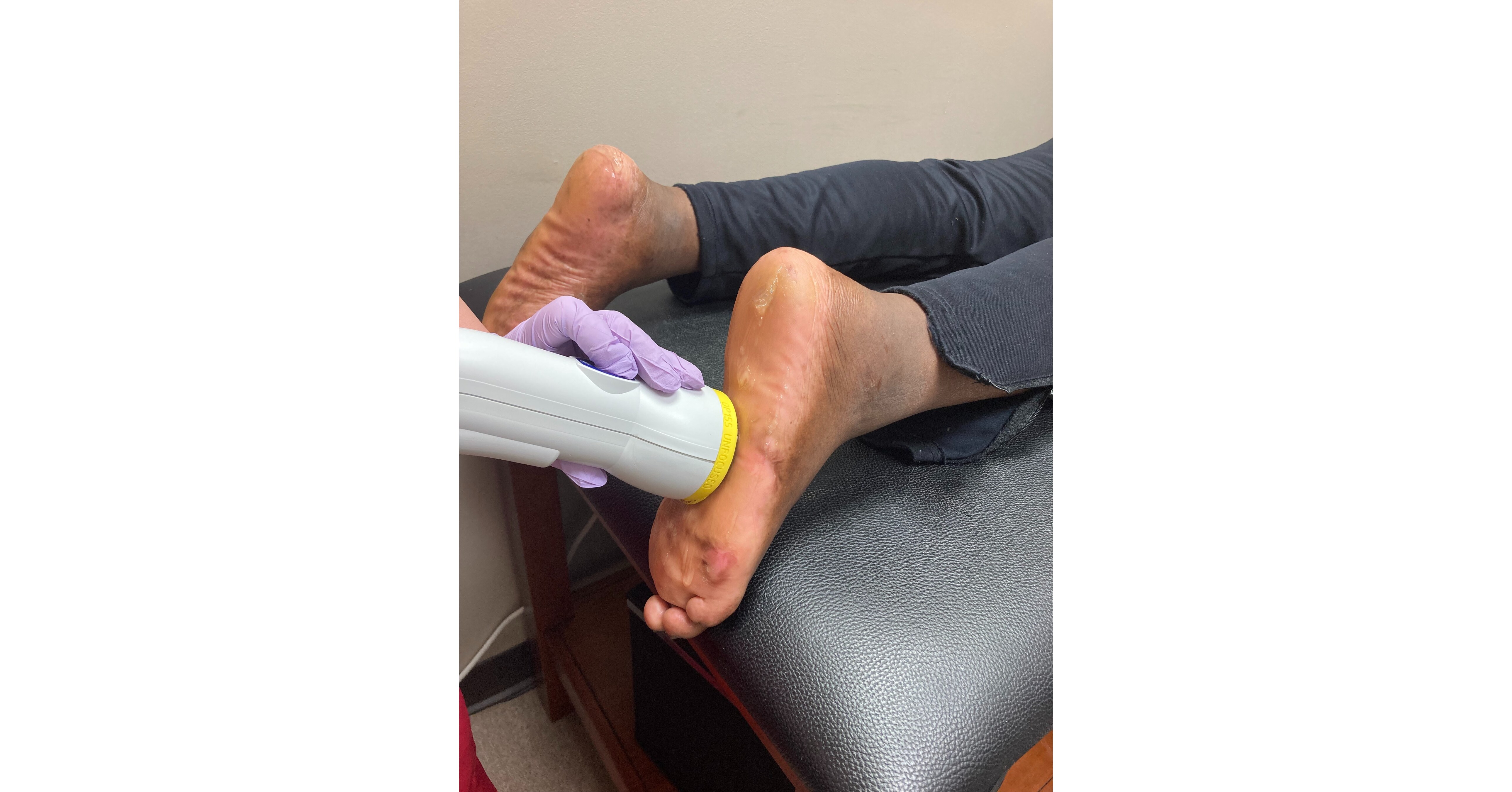Memphis Doctor Launches Breakthrough Non-Invasive RENEW Healing ...