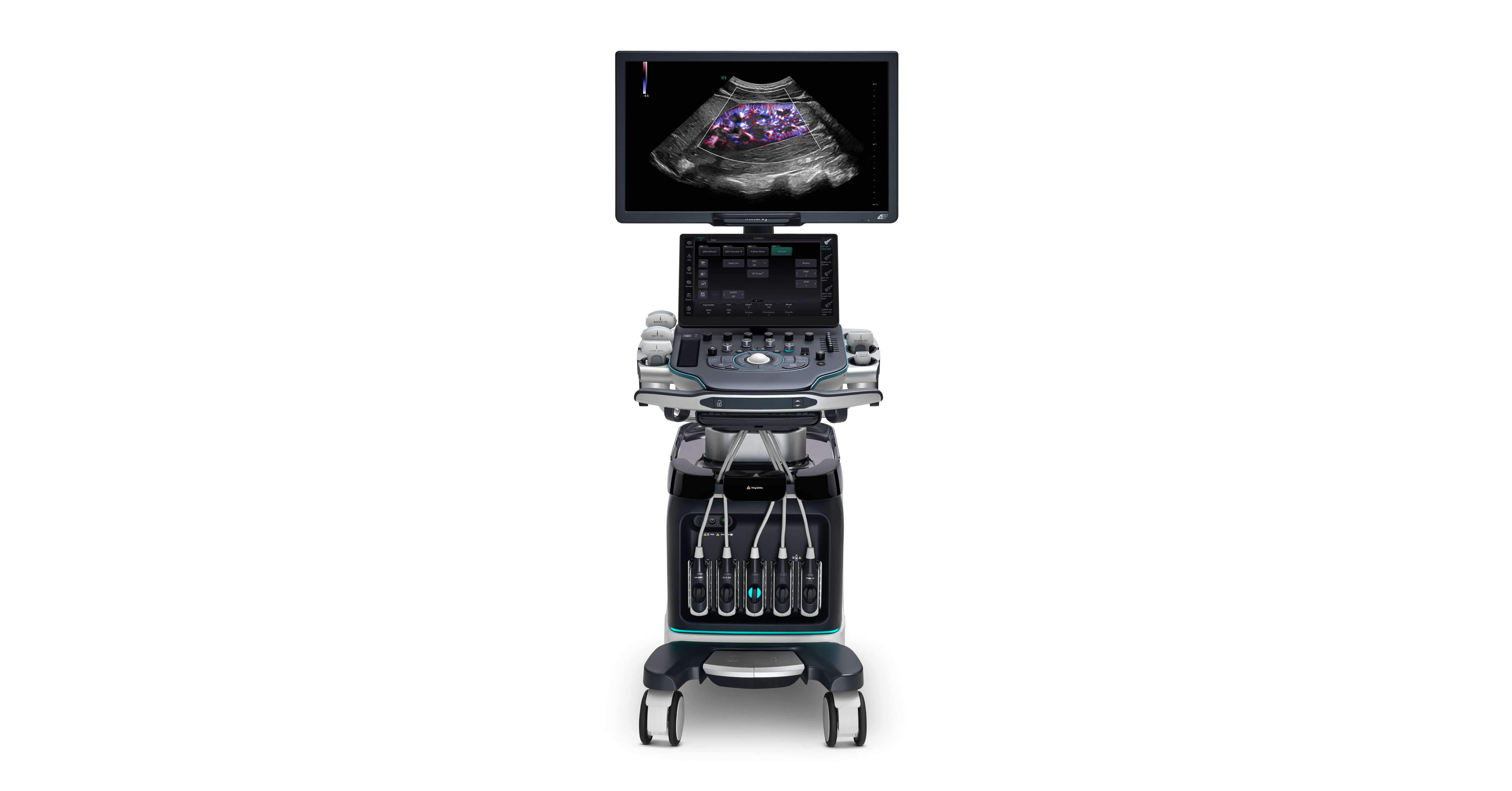 Mindray Unveils a Breakthrough in Ultra Premium Ultrasound at RSNA 2025 ...