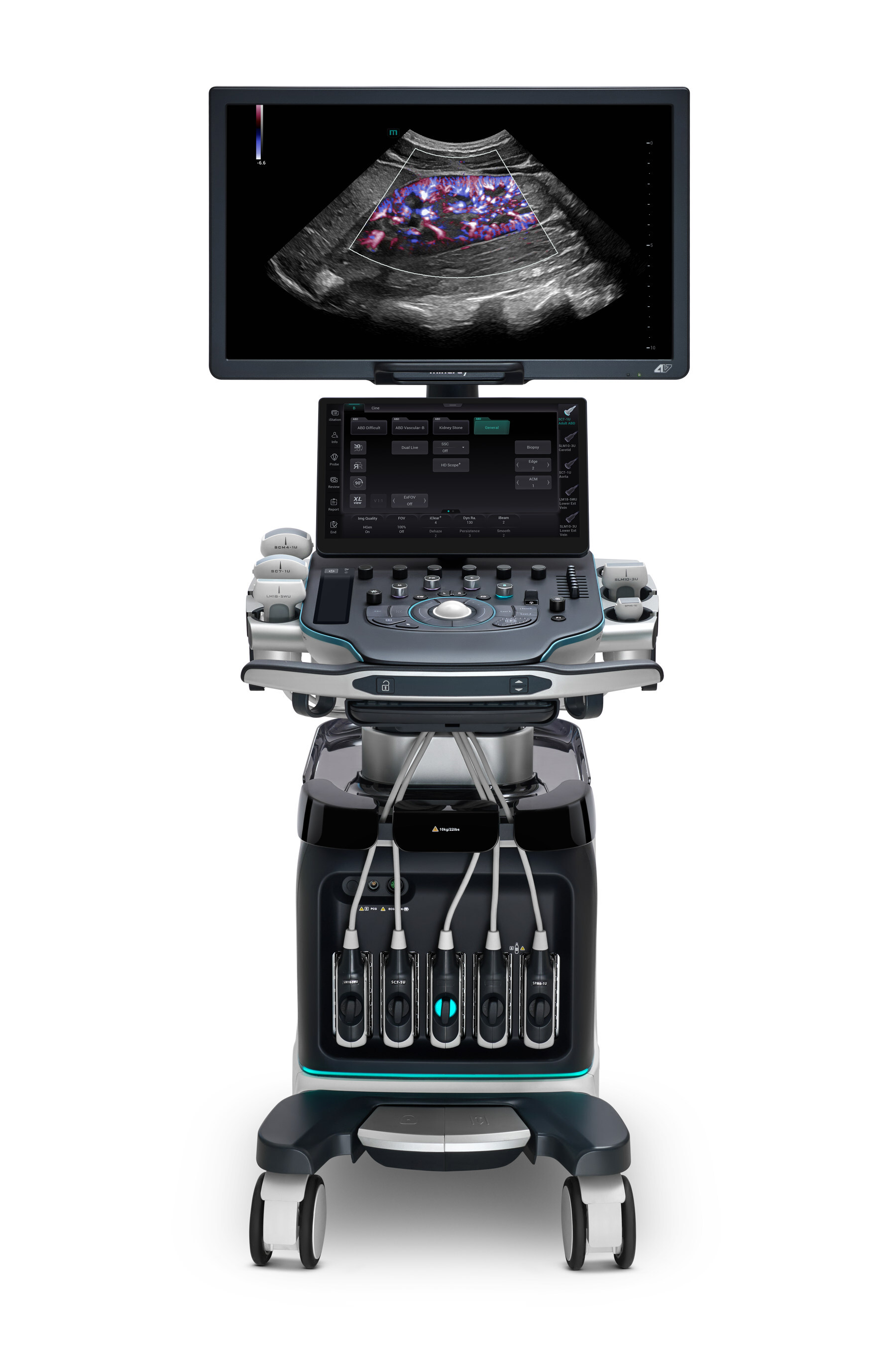 Mindray Unveils a Breakthrough in Ultra Premium Ultrasound at RSNA 2025 ...