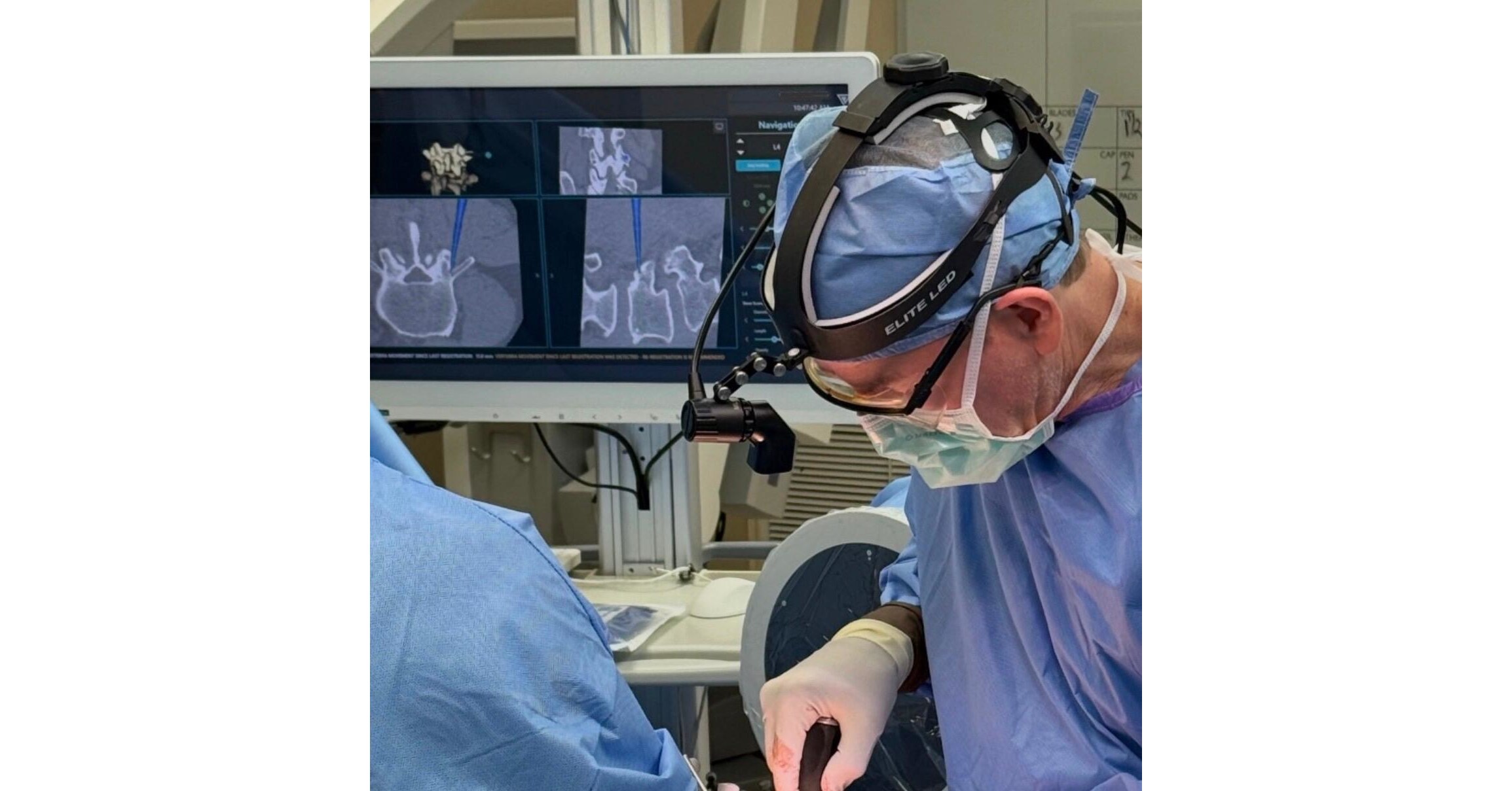 PathKeeper Surgical Achieves Outpatient Milestone, Validating Radiation ...