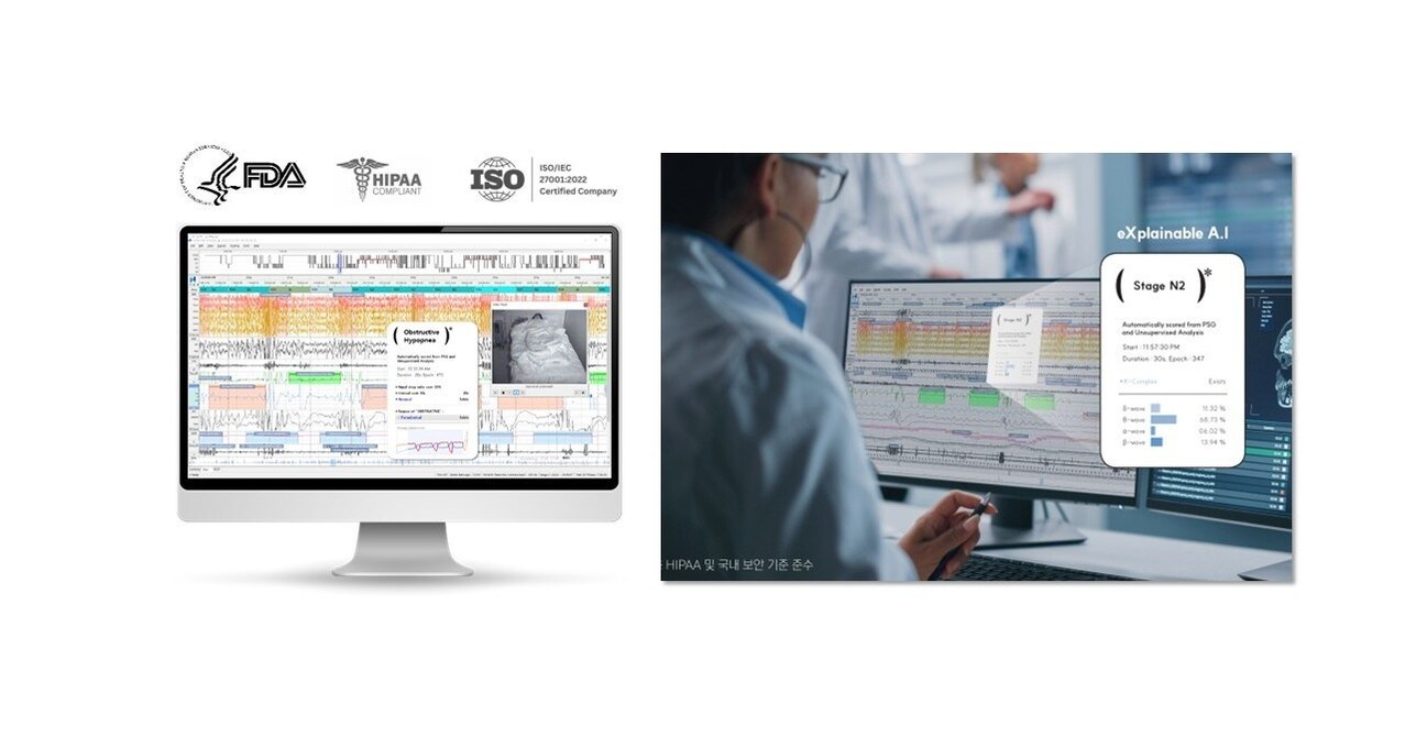 HoneyNaps Accelerates Clinical Trial Pipelines with FDA-Cleared AI "SOMNUM"