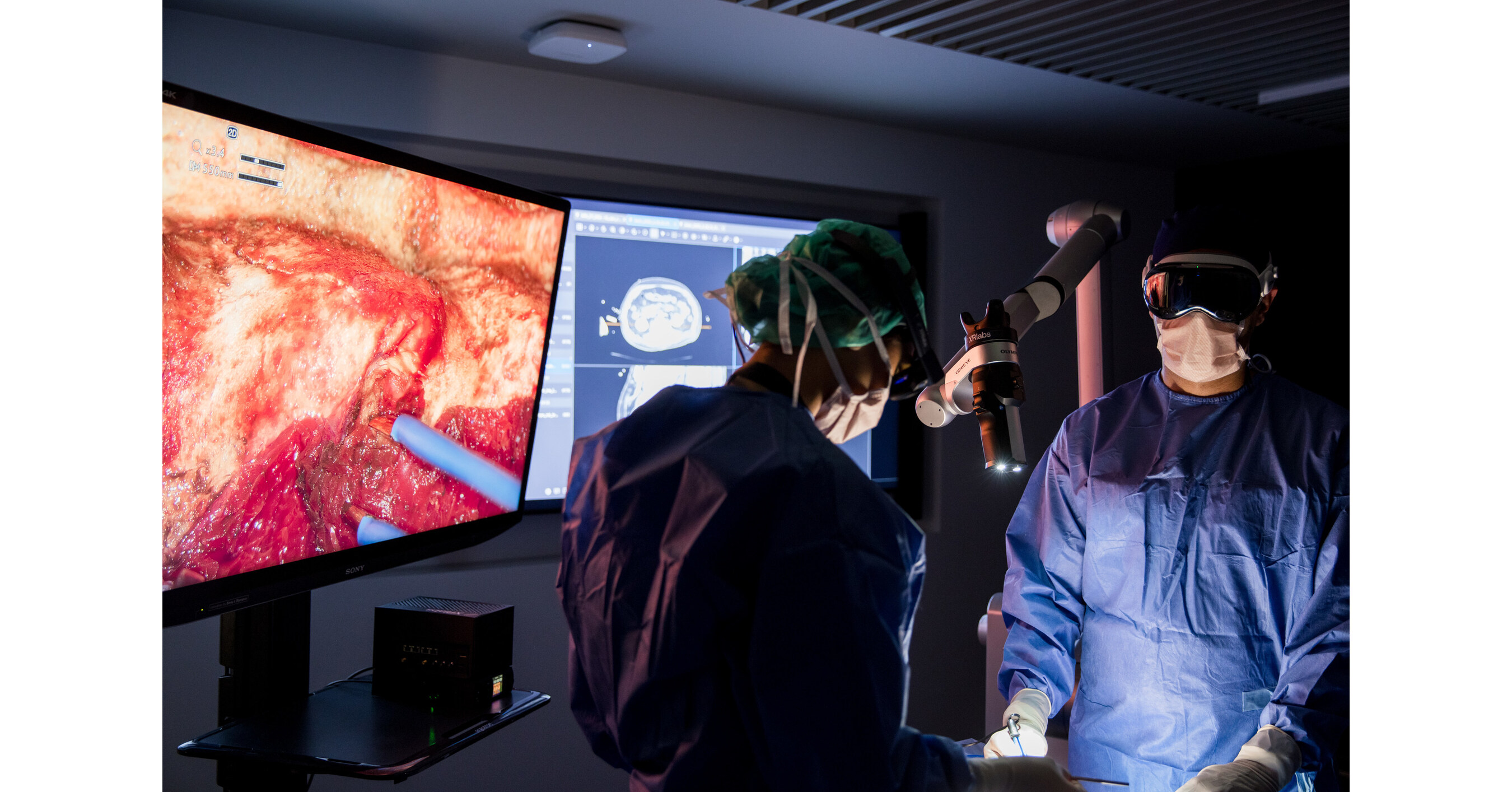 XRlabs Uses NVIDIA Jetson Thor and NVIDIA Isaac for Healthcare to Bring ...