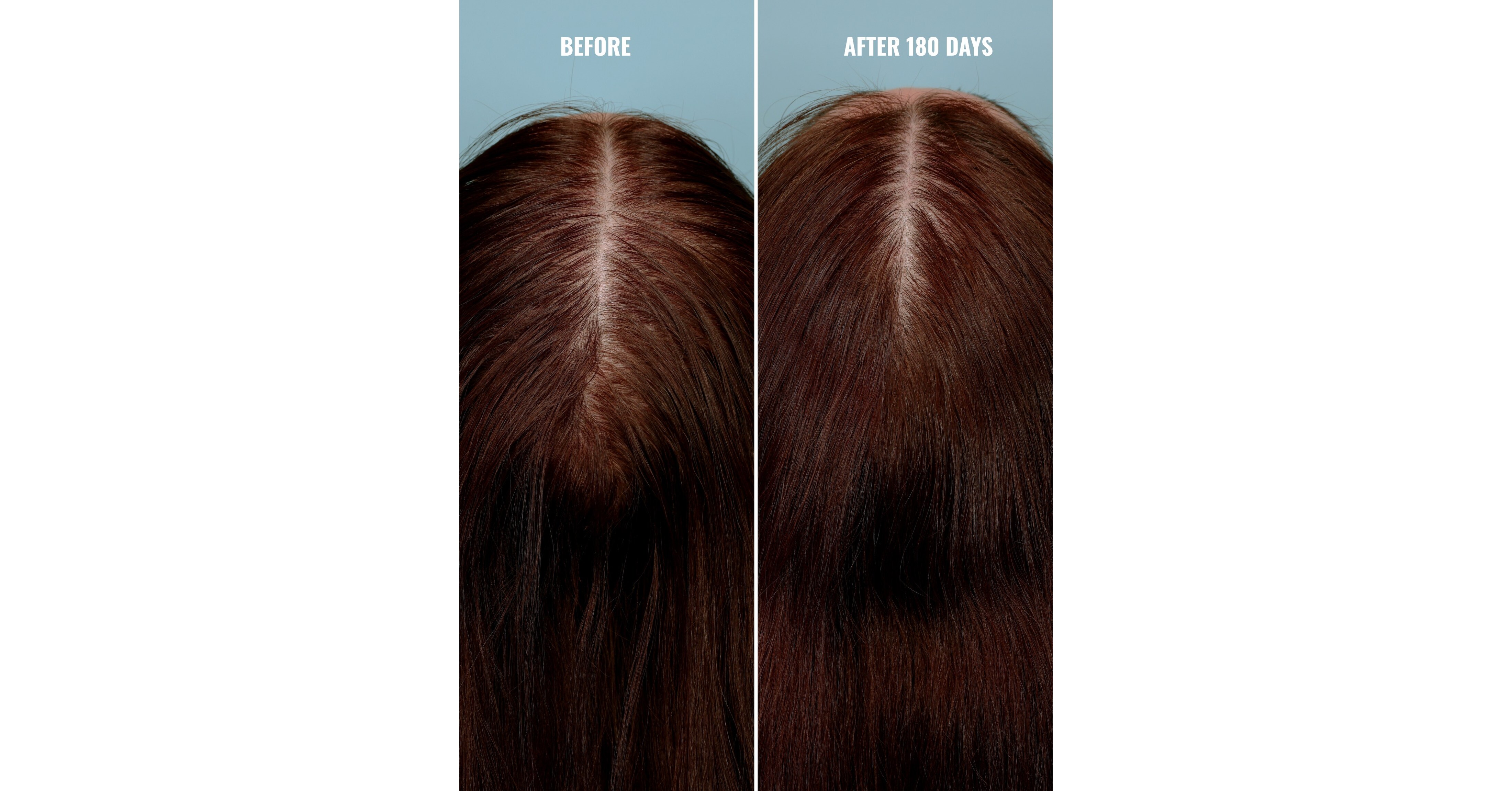 Live Conscious® Launches Clinical Hair Growth+ Supplement Featuring ...