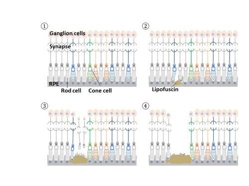 Lin Bioscience Licenses First-in-Class Therapeutic Program to treat Dry ...