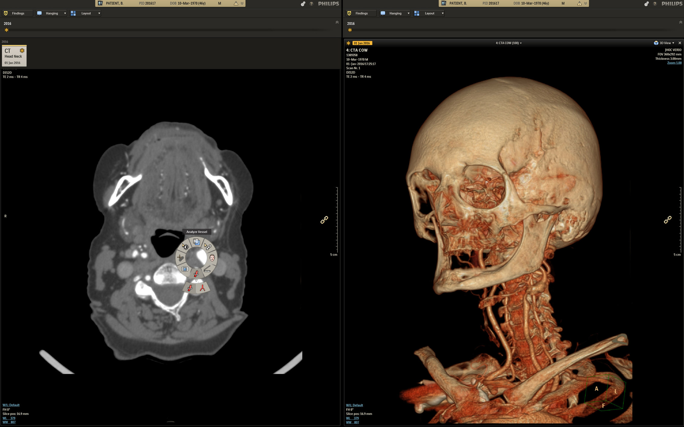 Philips launches IntelliSpace Enterprise Edition, an industry-first ...