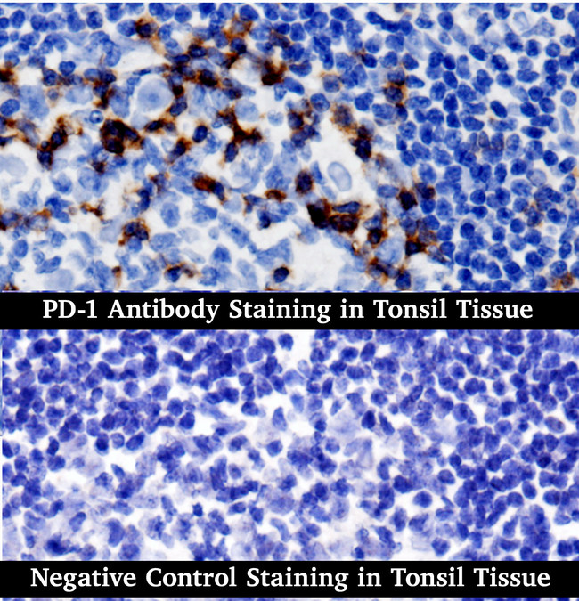 BioGenex Introduces PD1 and PDL-1 Antibodies for Immunohistochemistry (IHC)