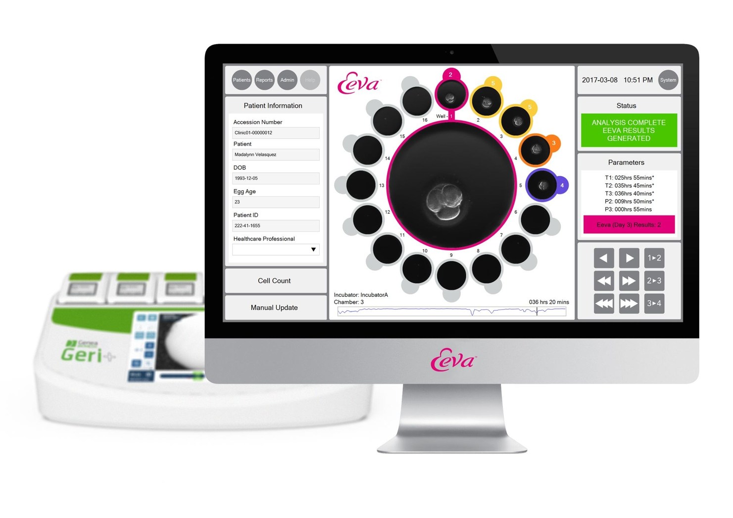 New Merck Technology Aims to Further Optimize Embryo Incubation and ...