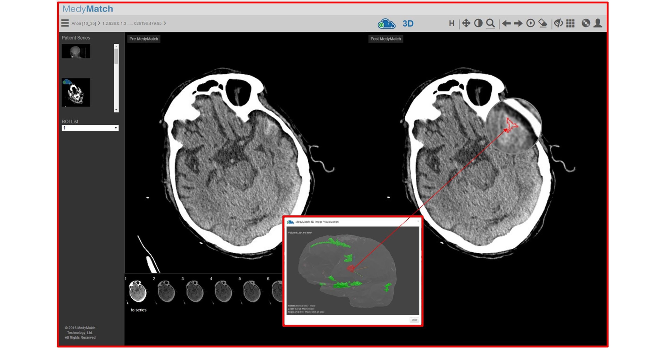 IBM Watson Health to Integrate MedyMatch Technology into Cognitive ...