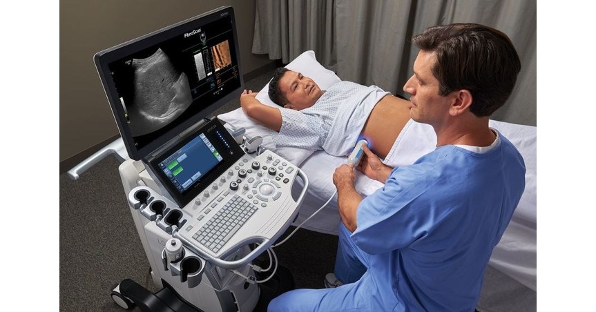 Echosens and GE Healthcare are Joining Forces to Offer a New Powerful ...