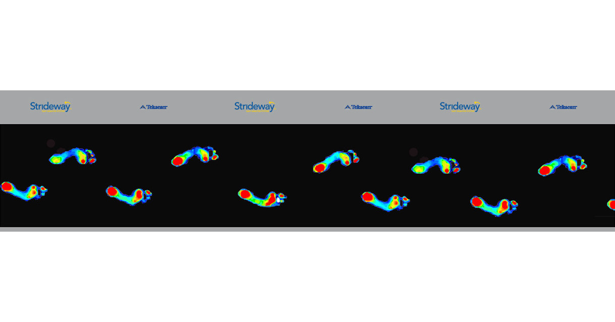 Gait Analysis Made Modular: Tekscan Launches New Strideway System for Gait Analysis