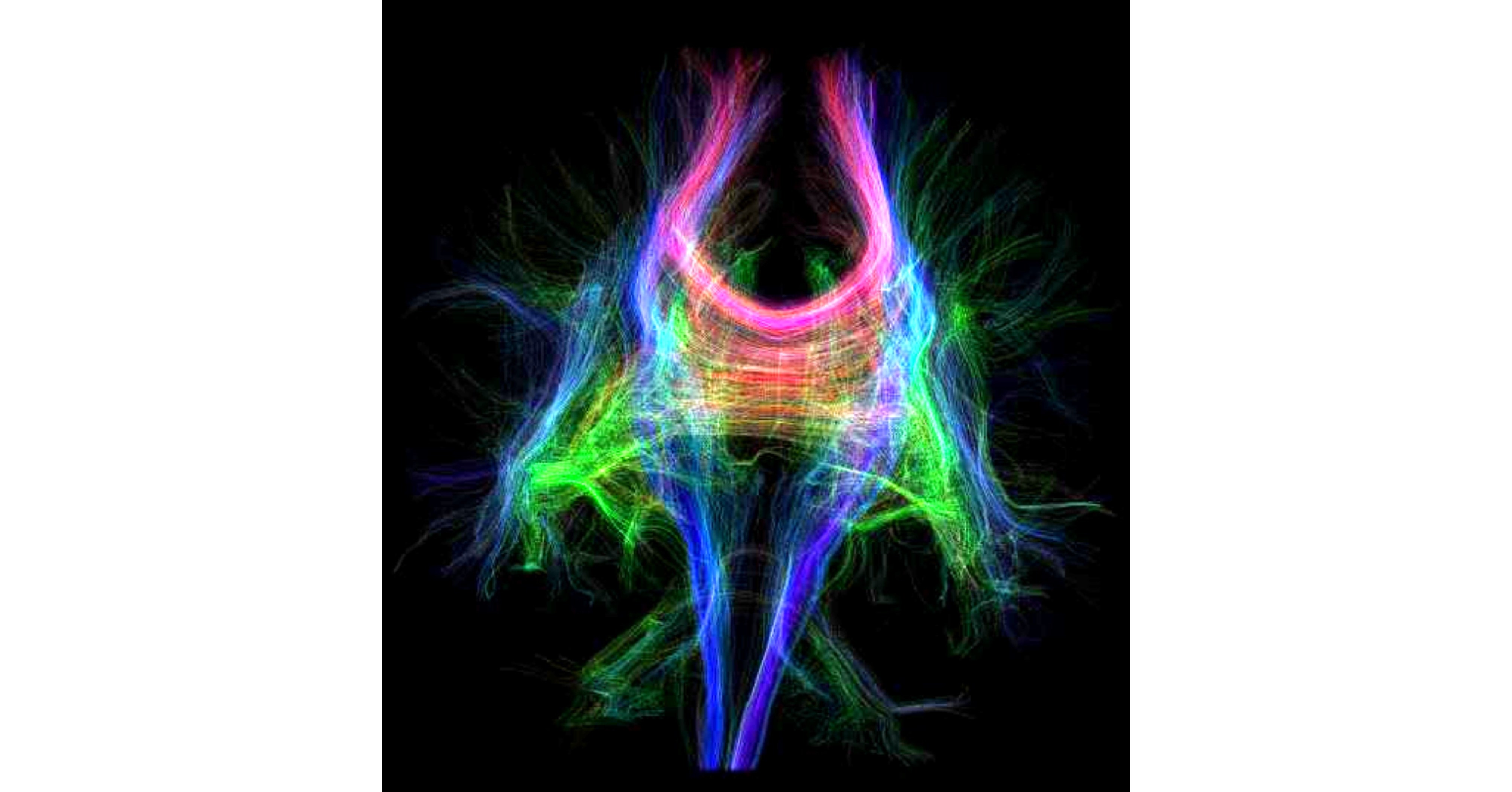 Philips showcases newest MR-based innovations and the value of ...