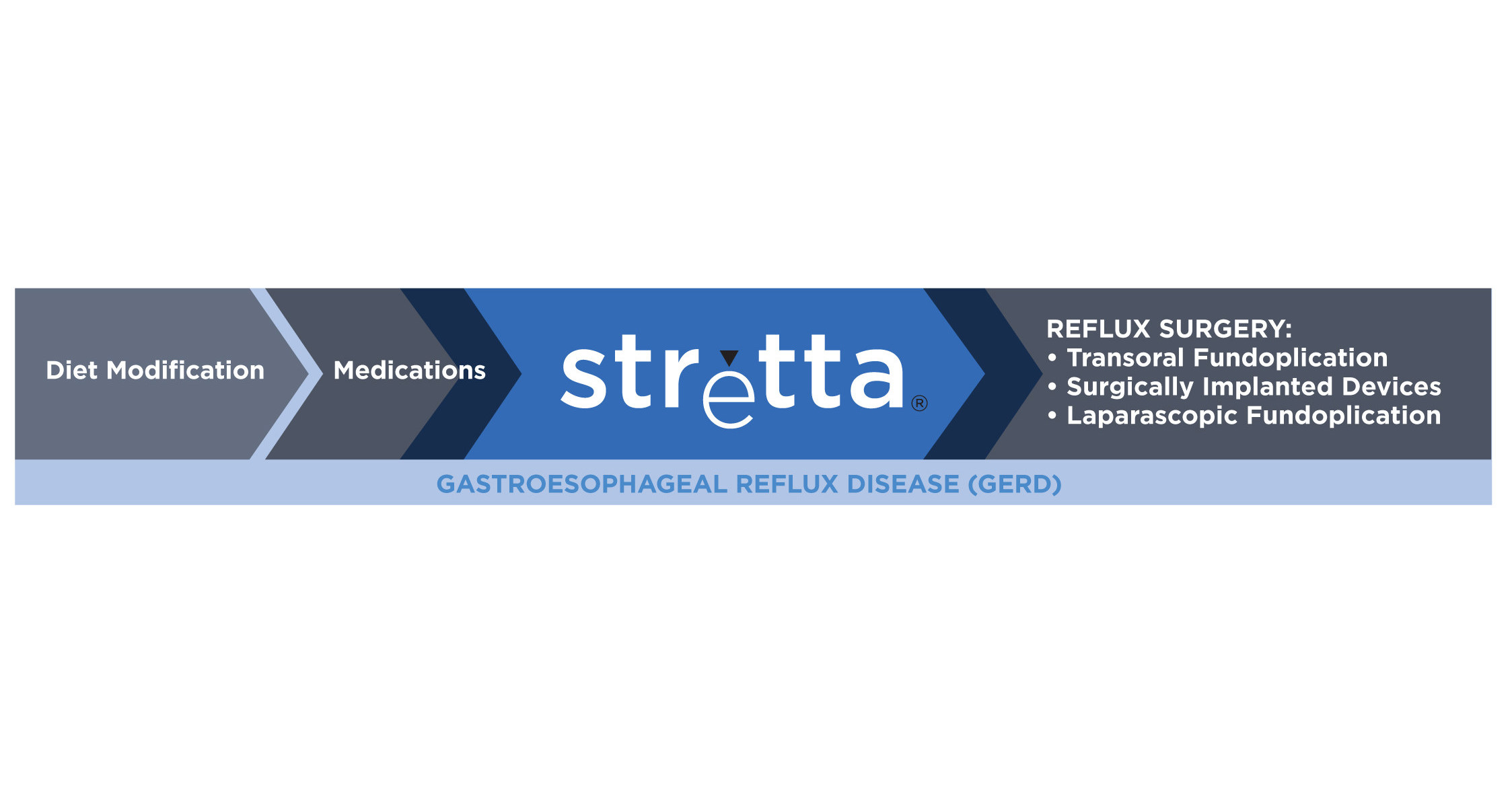 Stretta for GERD receives strong grade recommendation in a new Clinical ...