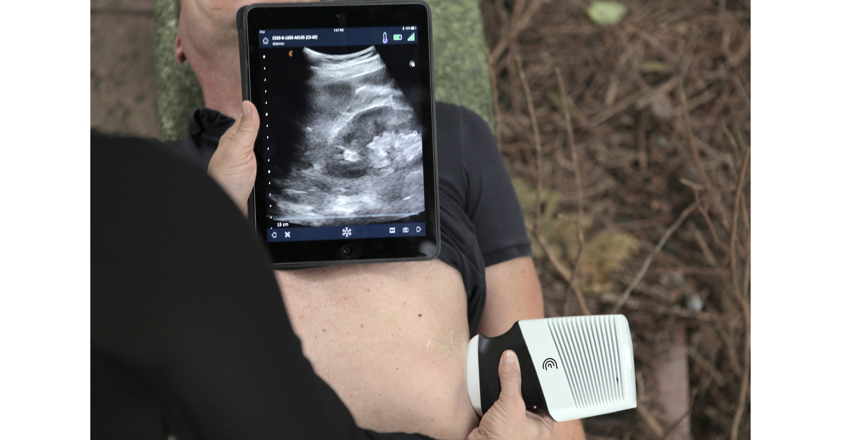 Clarius Demonstrates Ultrasound for Disaster and Emergency Medicine