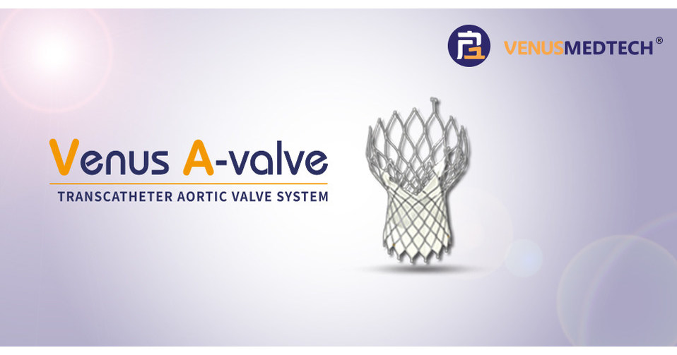 Venus Medtech's TAVR Device Is Approved By CFDA, Creating A New Era Of ...