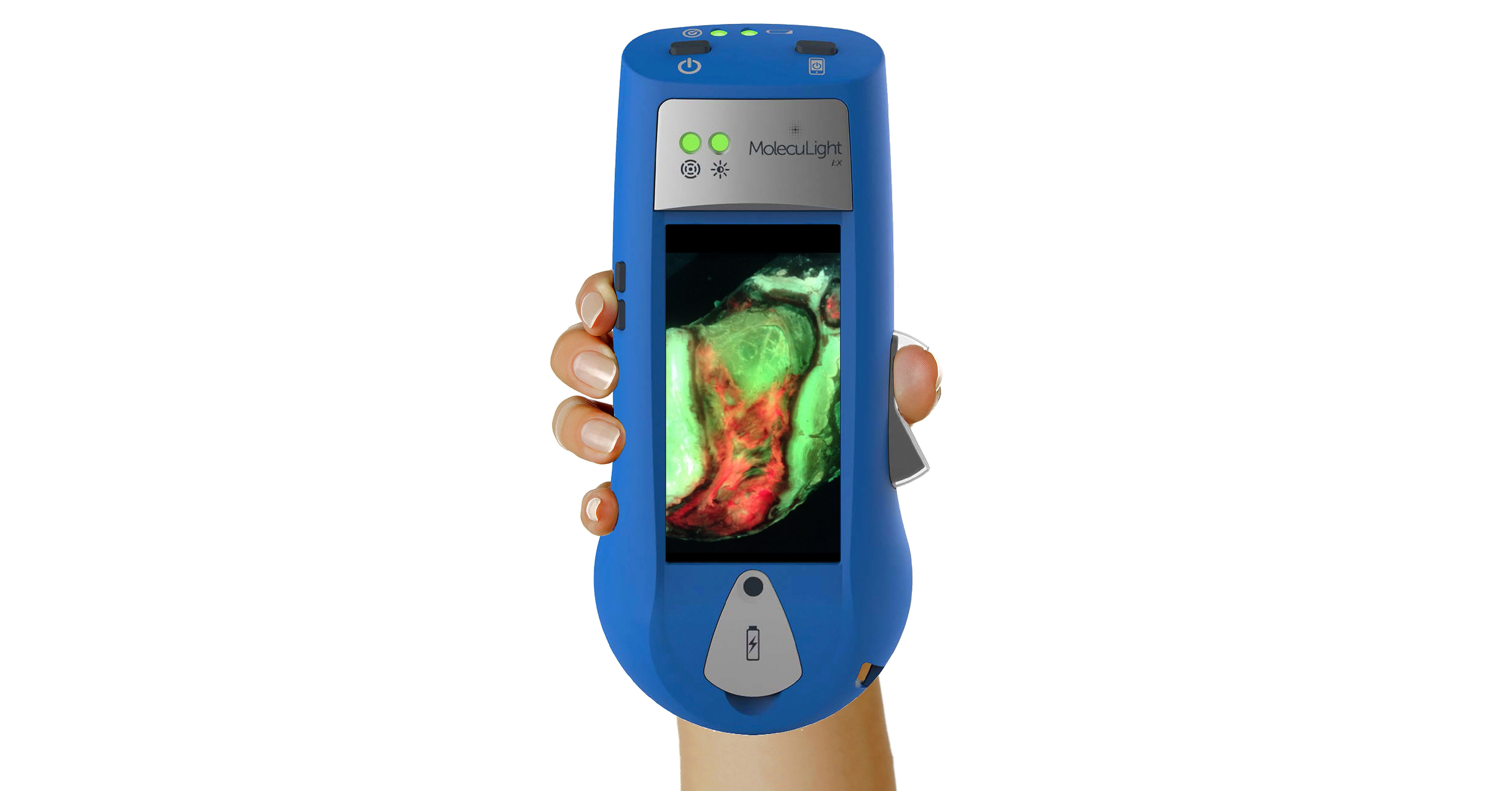 Smith & Nephew signs exclusive worldwide distribution agreement for the ...