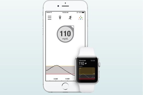 Dexcom G5® Mobile Continuous Glucose Monitoring (CGM) System now ...