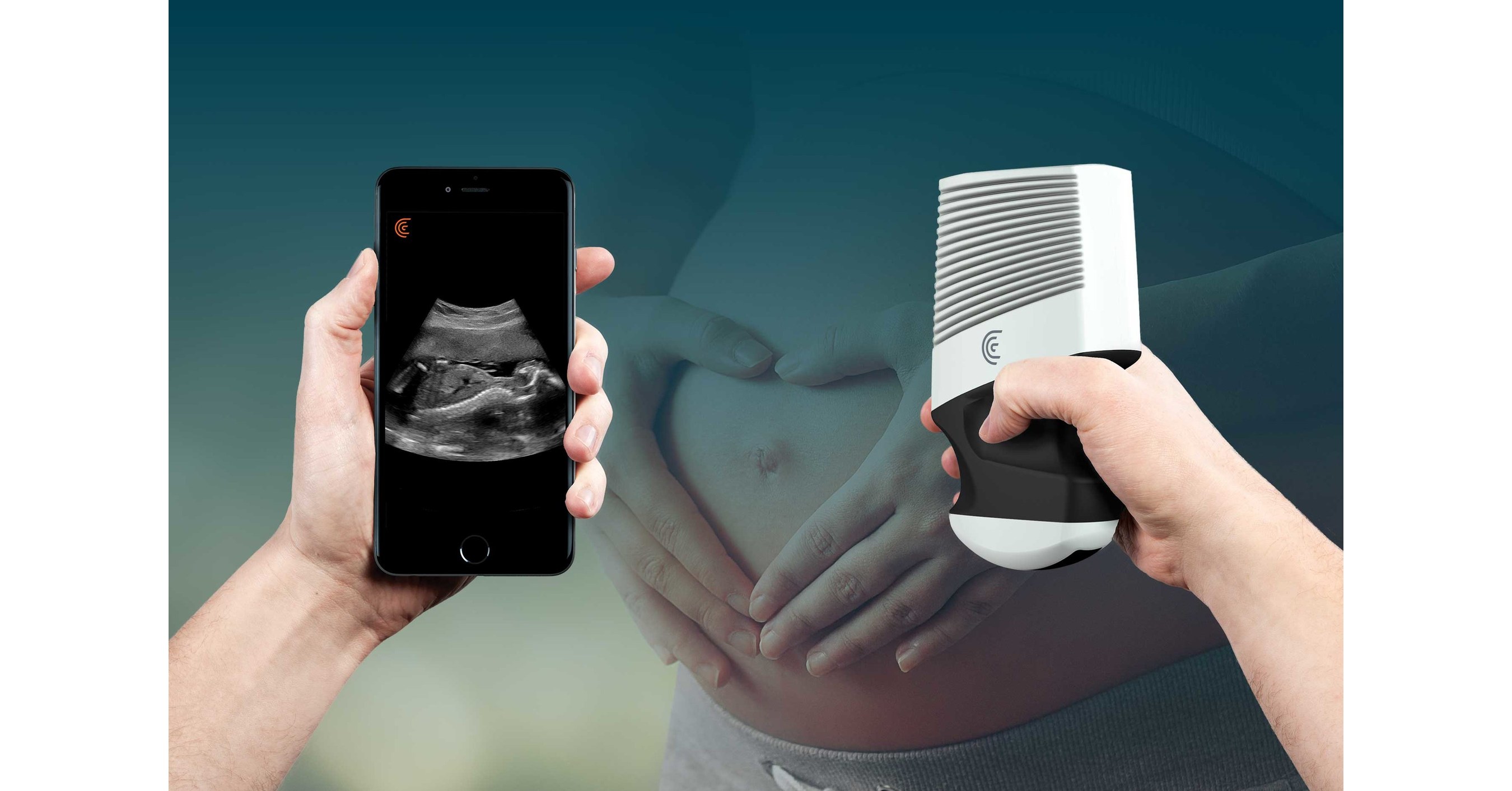Clarius Provides Quick Access to Ultrasound for Prenatal Care