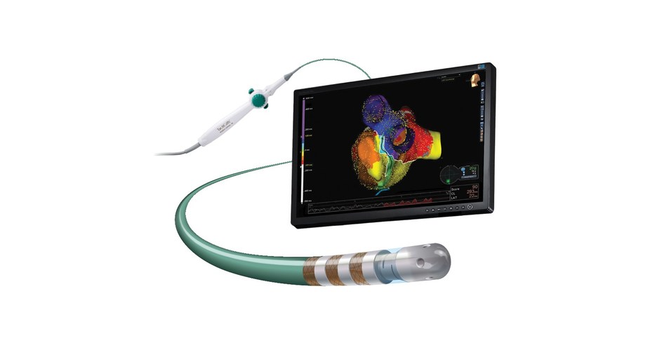 Abbott Announces CE Mark for TactiCath™ Contact Force Ablation Catheter ...