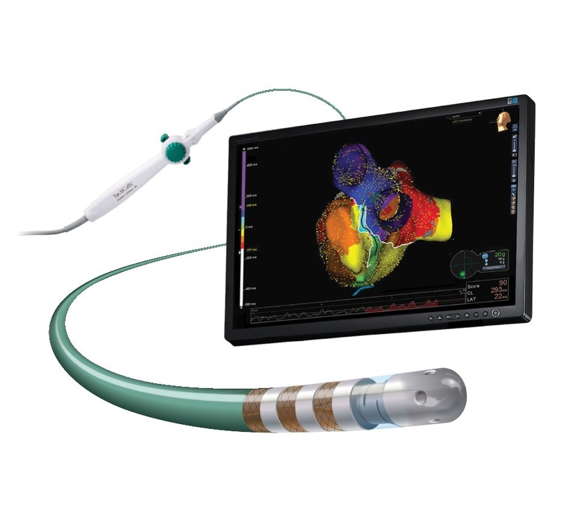 Abbott Announces CE Mark for TactiCath™ Contact Force Ablation Catheter ...