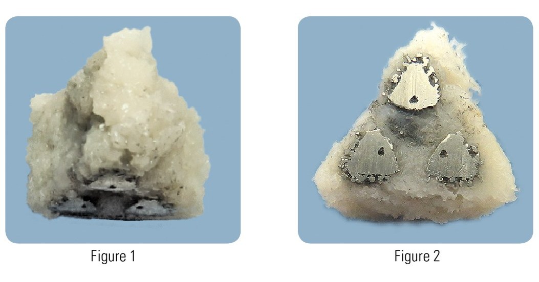 SI-BONE, Inc. Announces FDA Clearance and Full U.S. Commercial Launch ...