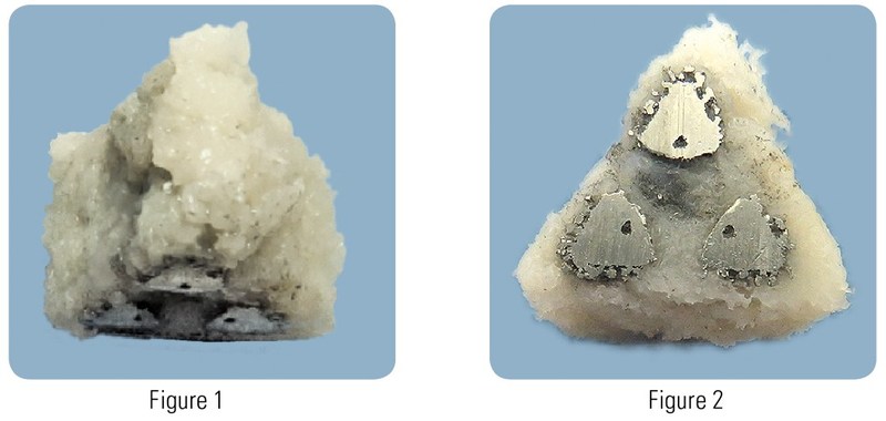 SI-BONE, Inc. Announces FDA Clearance and Full U.S. Commercial Launch ...