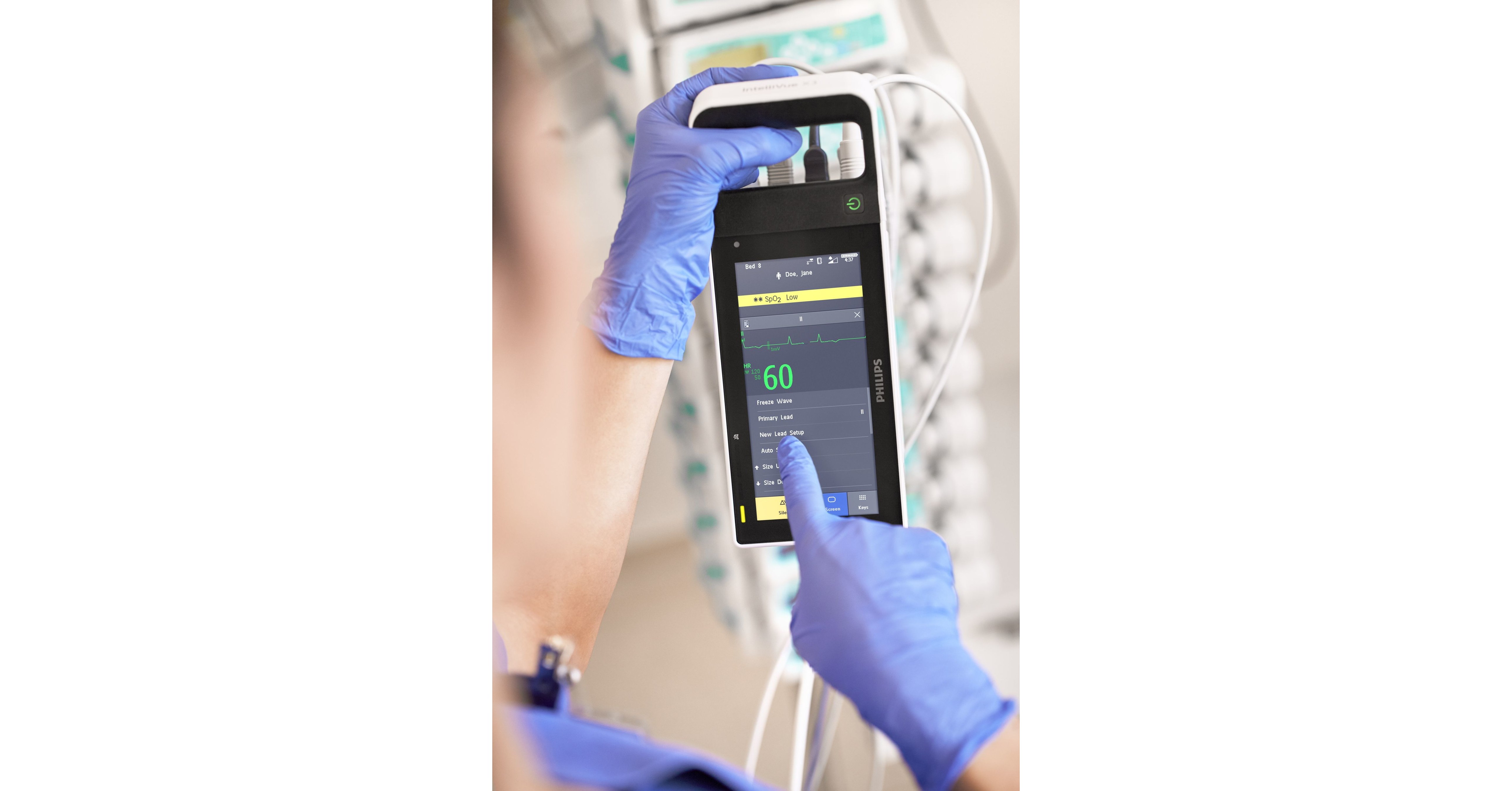 Philips Unveils IntelliVue X3 in Europe for Continuous Critical Care ...