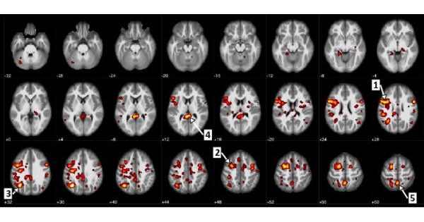 IBM and University of Alberta Publish New Data on Machine Learning ...