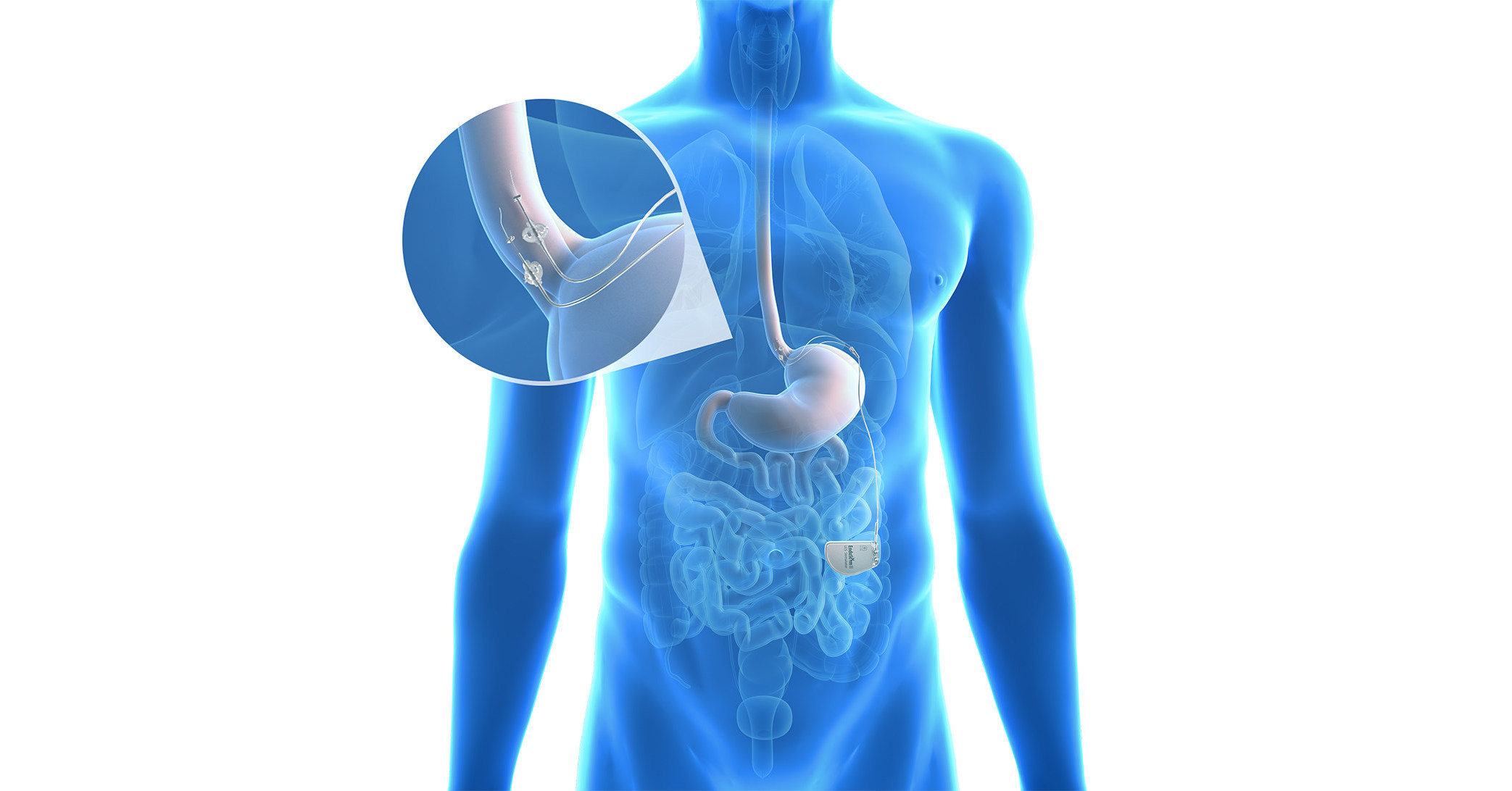 First patient at The Ohio State University Wexner Medical Center ...