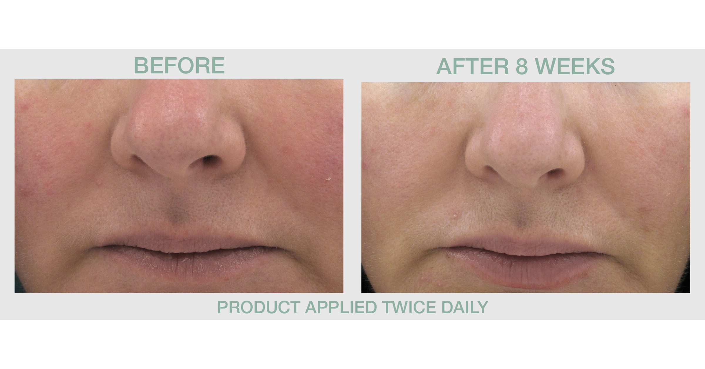 Topix Pharmaceuticals Reveals the Top 3 Ways to Recover from Summer ...