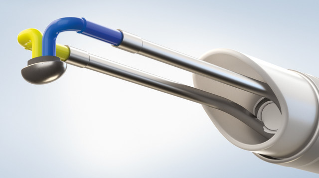 Olympus Bipolar TURP With Plasma Resection Study Demonstrates Procedure Olympus Bipolar TURP With Plasma Resection Study Demonstrates Procedure