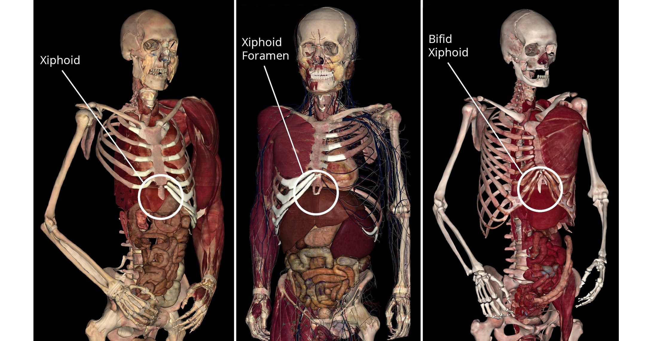Virtually Dissect Real Human Anatomy With Anatomage's Advanced ...