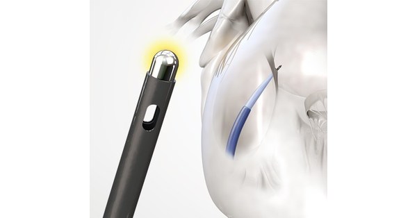 Baylis Medical teams with national Centre of Excellence to improve the ...