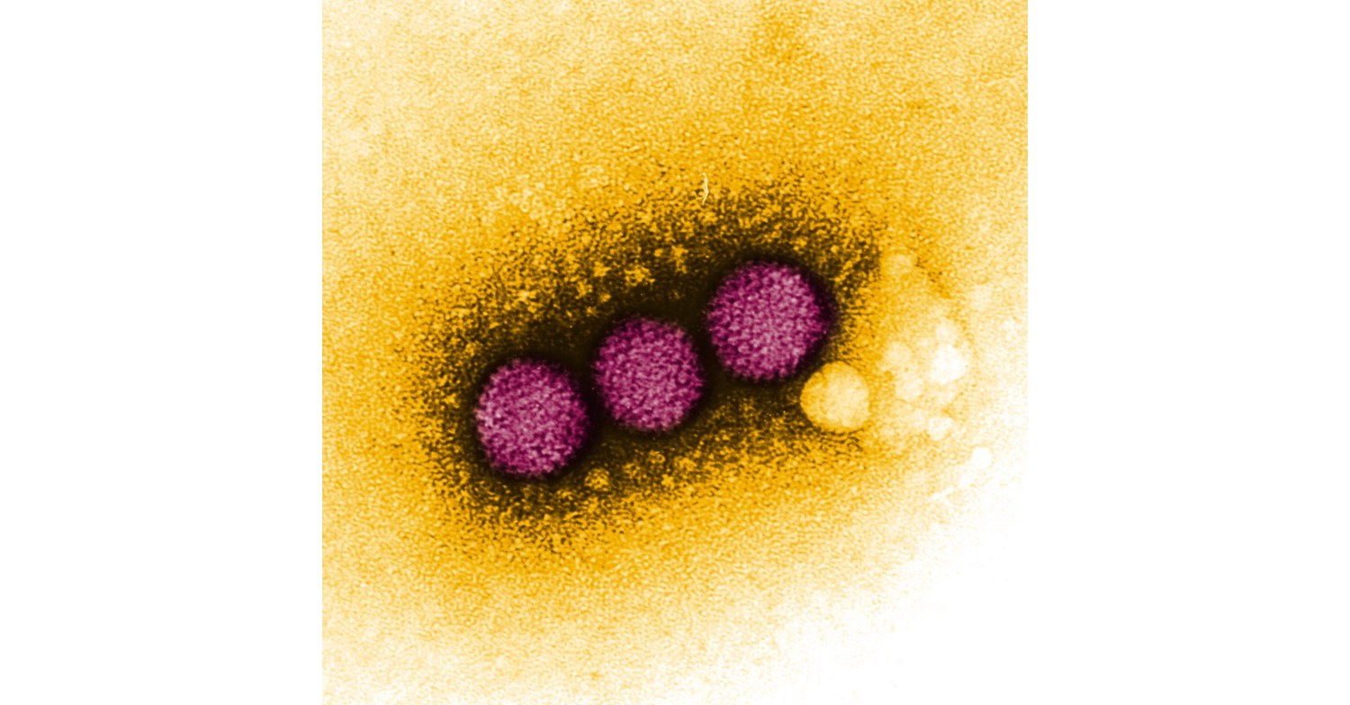 MilliporeSigma Brings Customers Closer to Gene Therapy Product ...