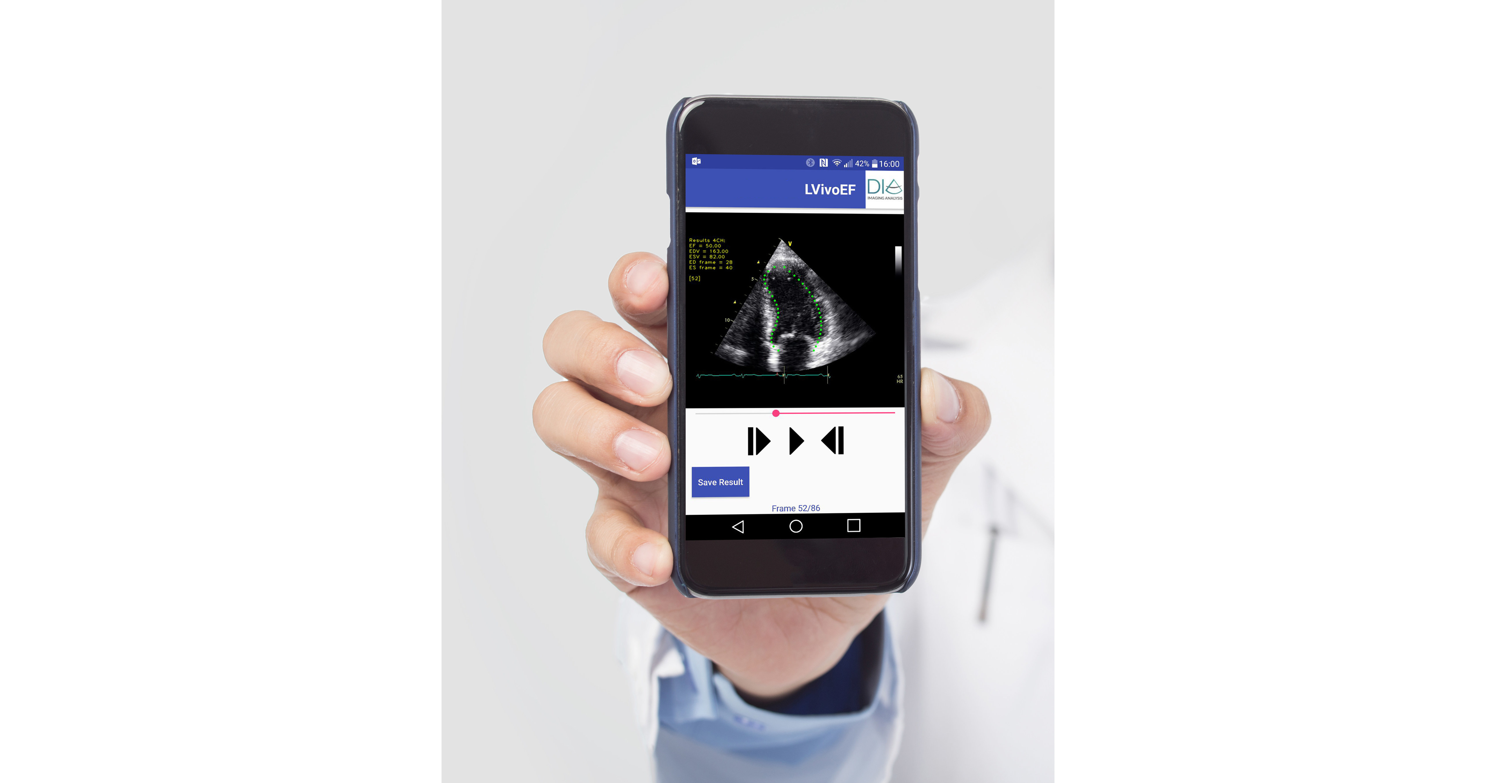 DiA Imaging Analysis Enters Partnership with GE Healthcare on Automatic ...