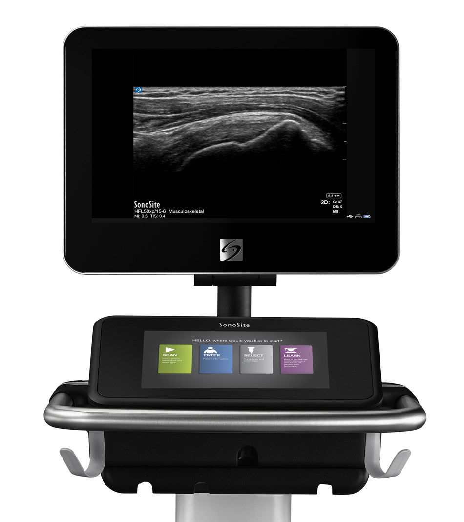 FUJIFILM SonoSite Presents Point-of-Care Ultrasound Portfolio At RSNA 2017
