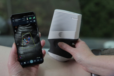 Signify Research Reports Ultraportable Ultrasound Market to Grow by 40%