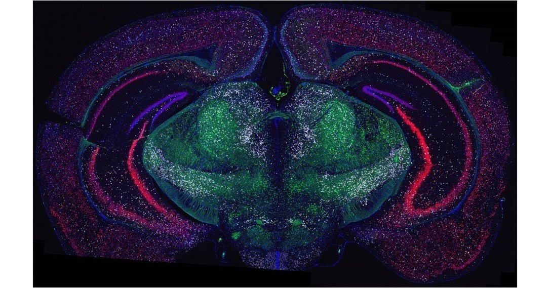 Bio-Techne's RNAscope® Technology Enabling Robust Gene Expression and ...