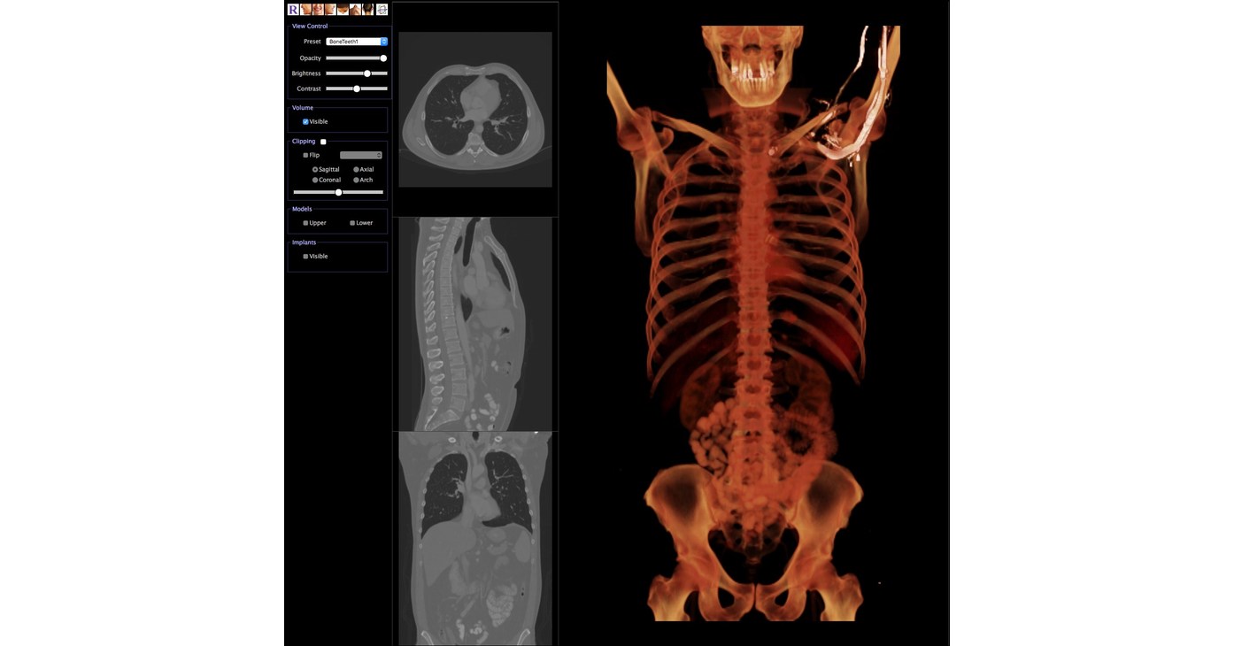 Anatomage Inc. Launches Cloud Platform For Easy Medical Image Sharing