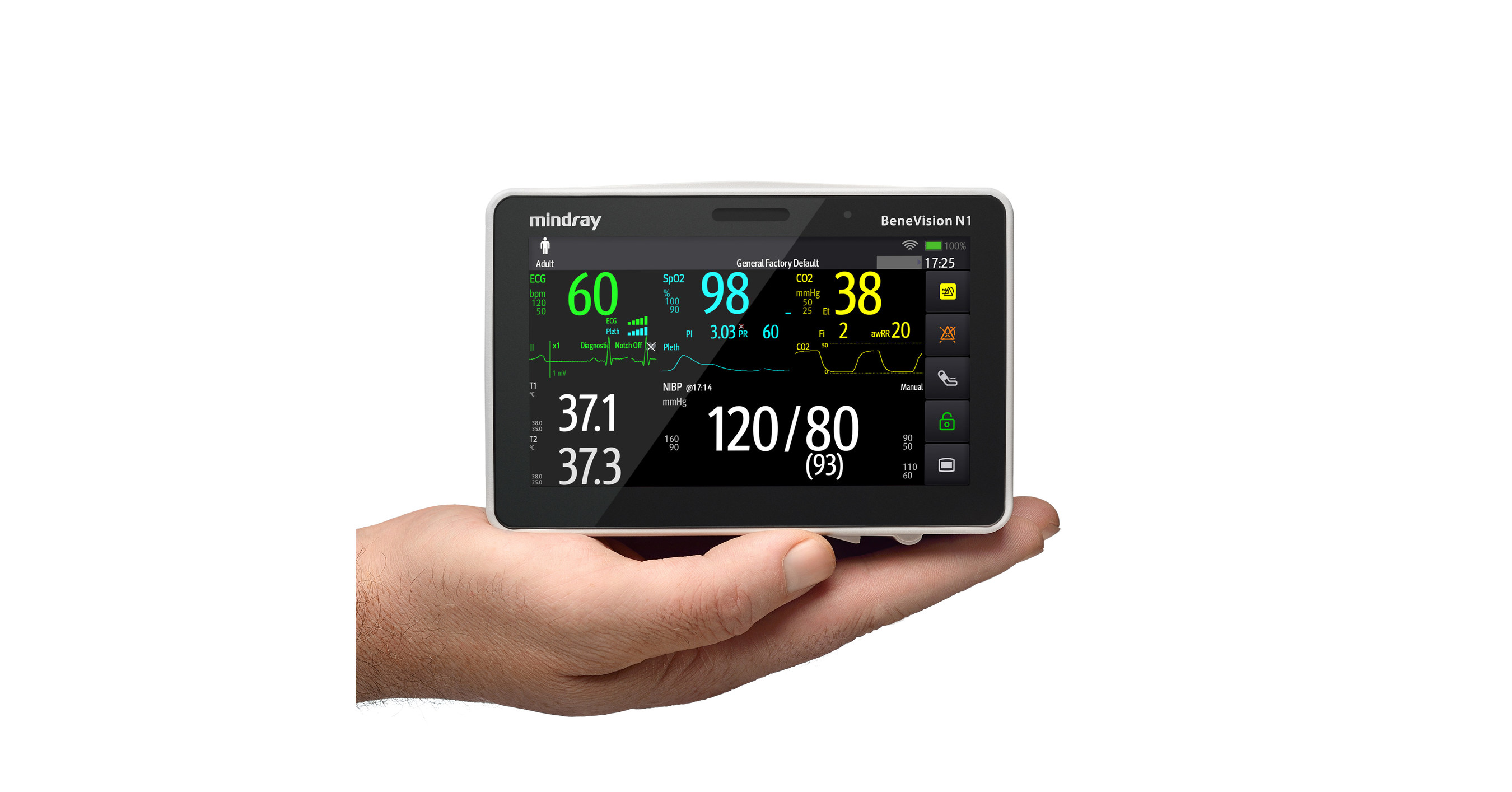 Mindray introduceert BeneVision N1 voor ononderbroken monitoring ...