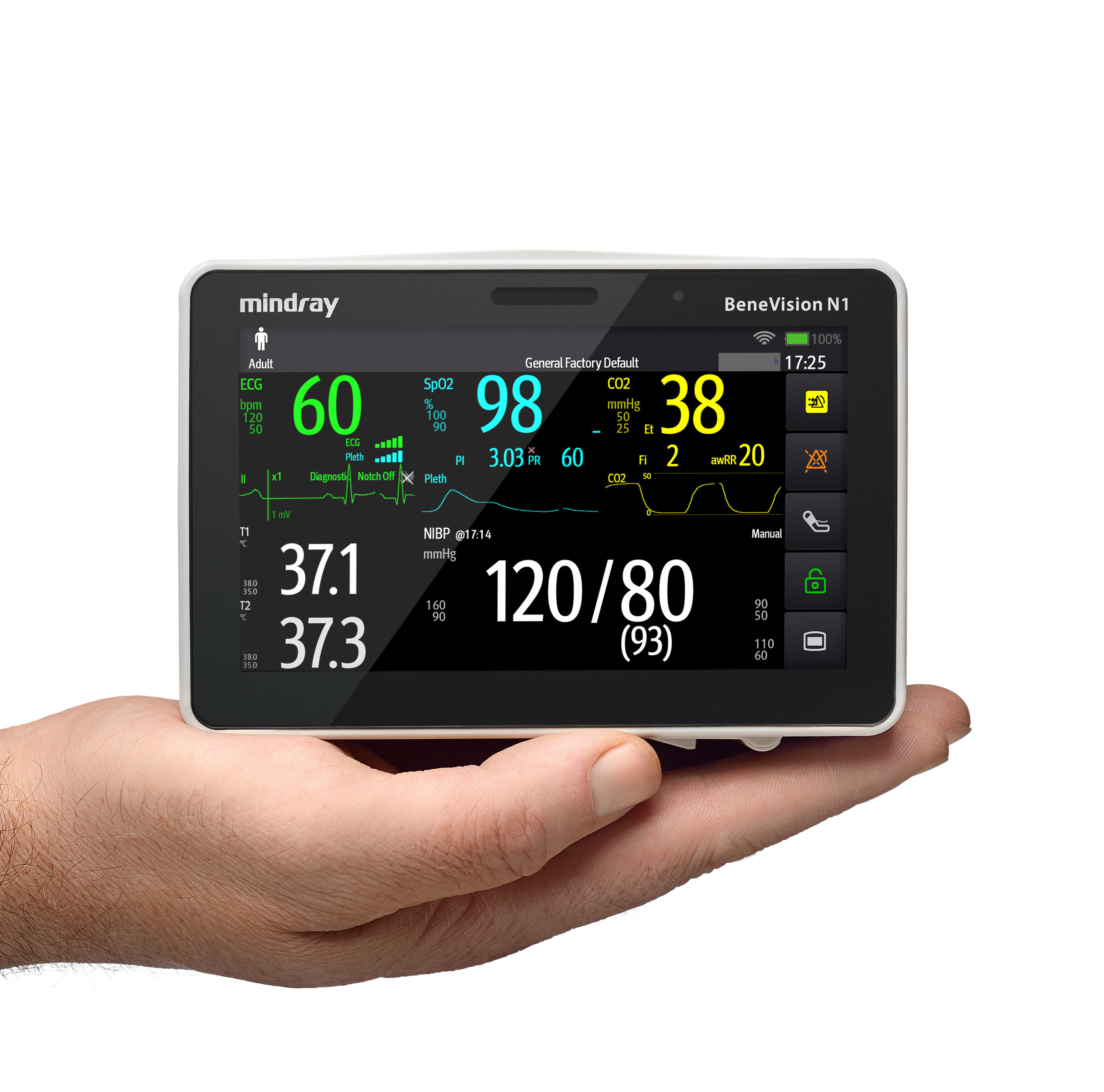 Mindray launches BeneVision N1 for uninterrupted monitoring during ...