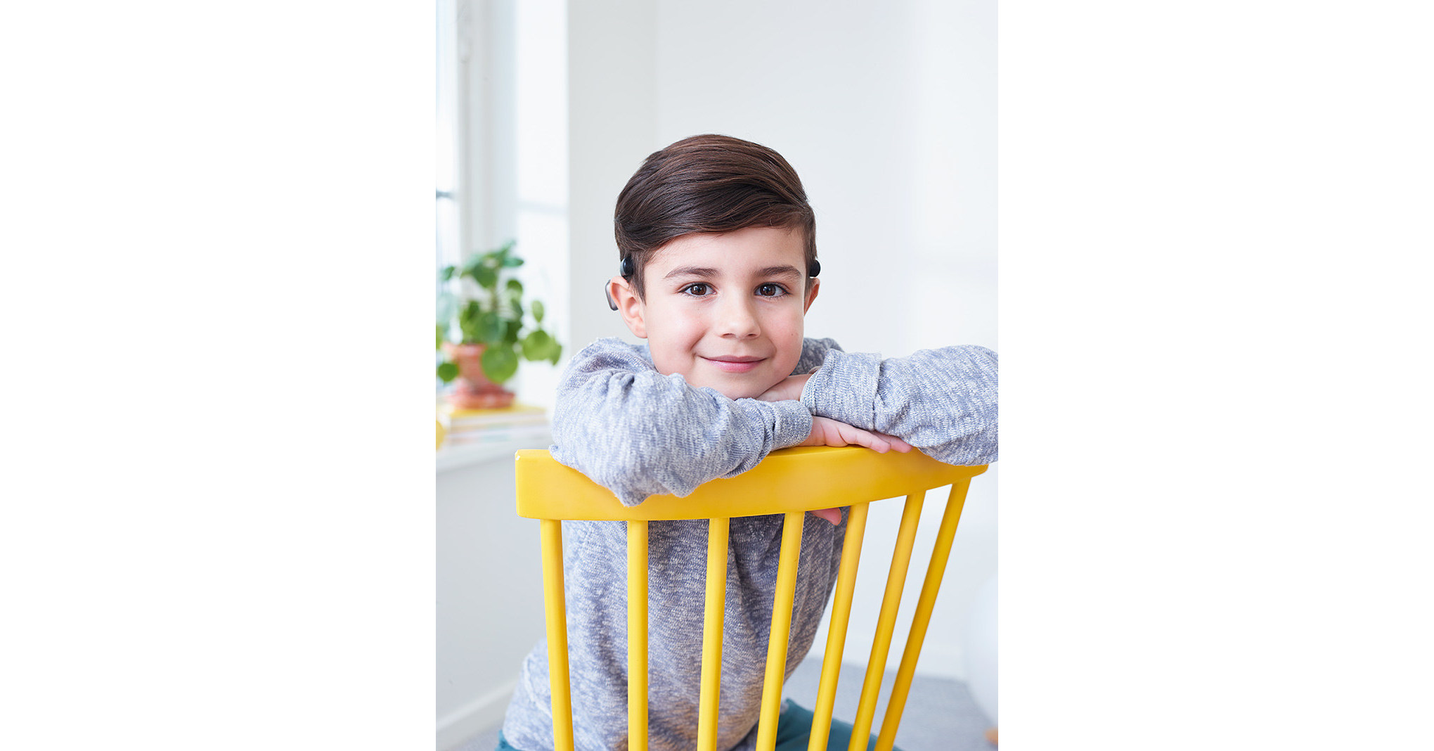 Cochlear Americas announces the release of the Baha SoundArc