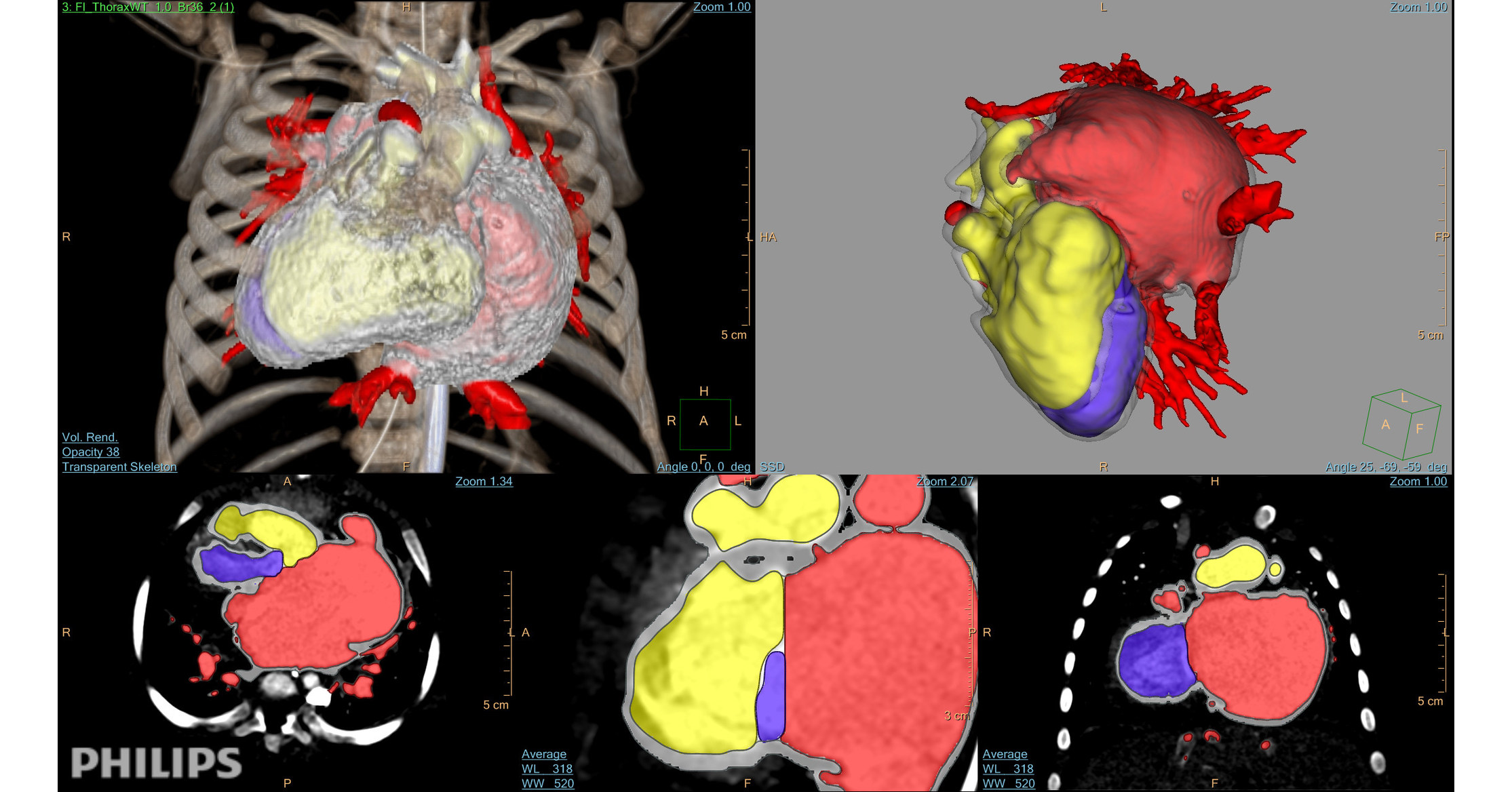 Philips IntelliSpace Portal named KLAS 2018 Category Leader for ...