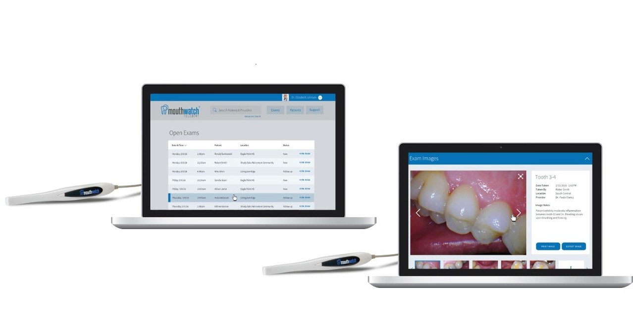 MouthWatch, LLC Debuts its TeleDent™ Referral Engine Starter Kit for ...